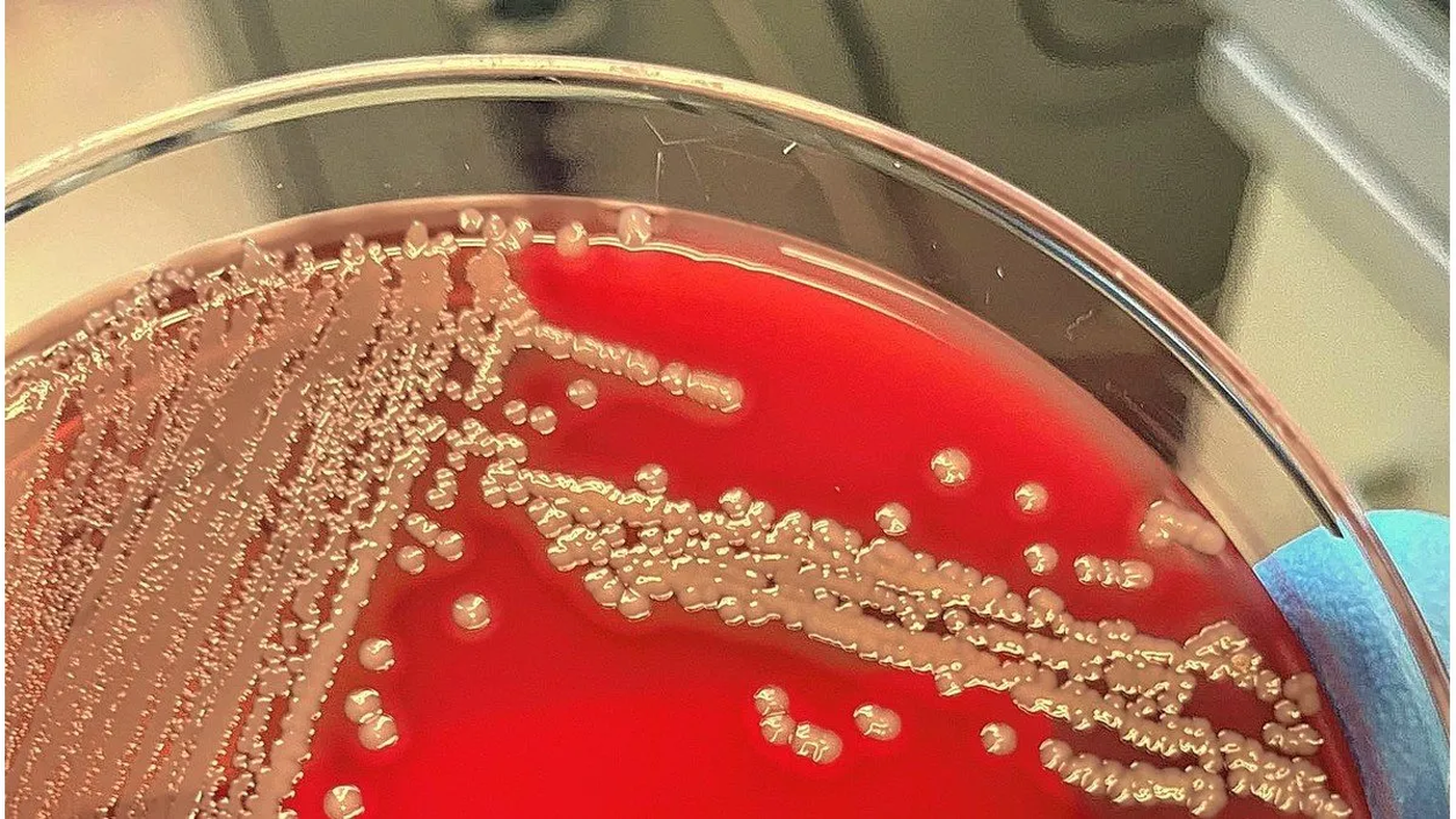 Bacteria Streptococcus Pyogenes: ¿cuáles son los síntomas y cómo es el ...